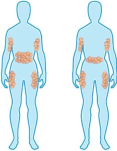Non-surgical Fat Reduction | Dr Joycelim Dermatologist & Skin Specialist